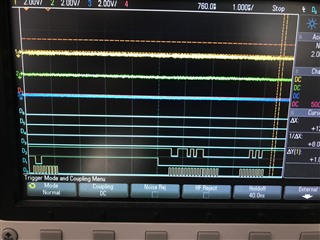 NRF52 not reading third SPI byte - Nordic Q&A - Nordic DevZone - Nordic DevZone
